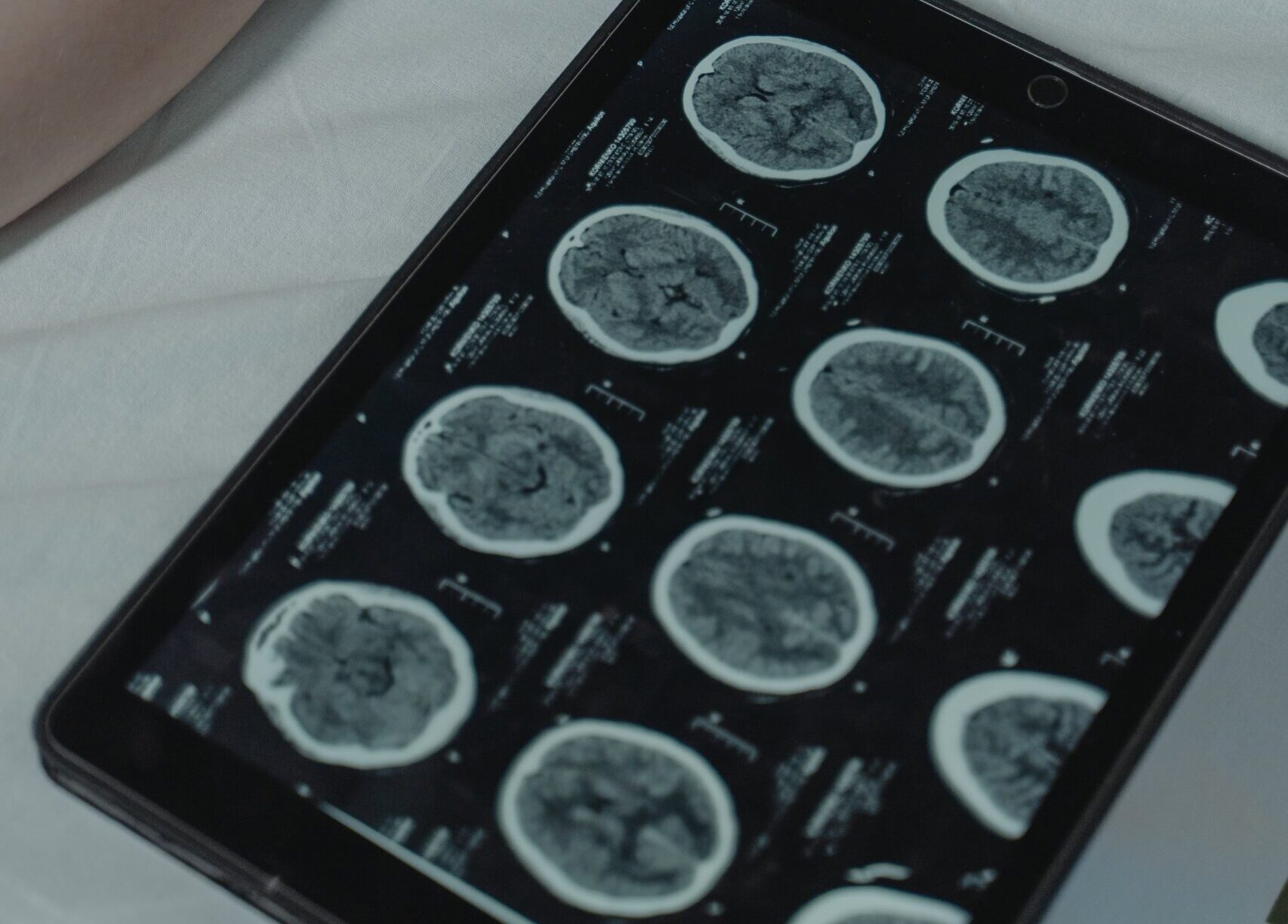 Neurofeedback para Pacientes com Doenças Neurológicas - TI Esti